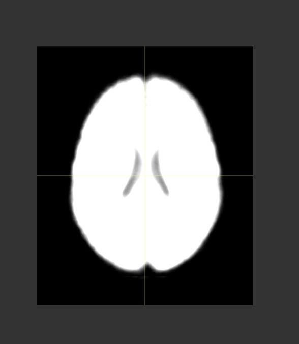 Cut planes all white when volume unchecked · Issue #494 · IbisNeuronav/Ibis · GitHub