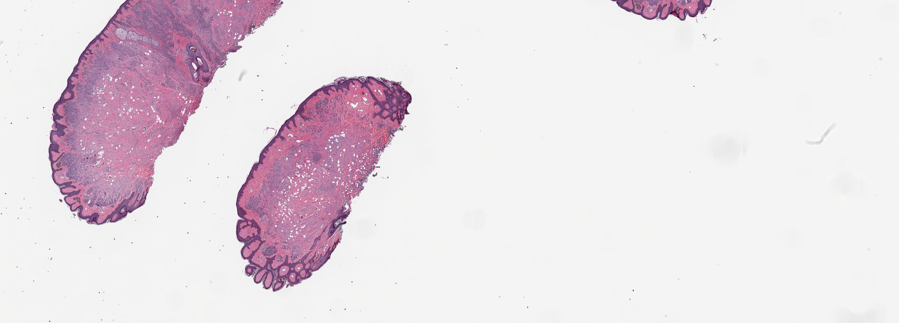 Inconsistent pixel value when fetching with non zero offset · Issue ...