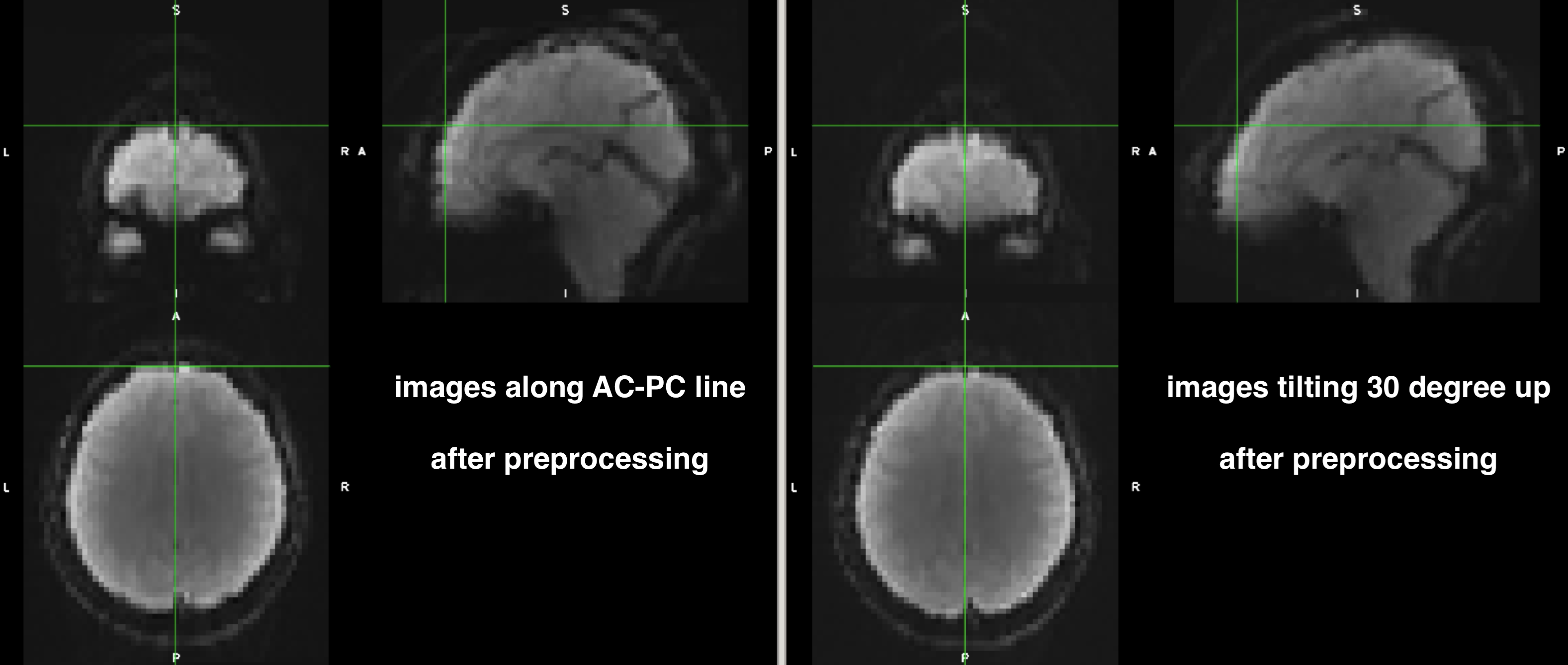 Failed Normalization of BOLD · Issue #2410 · nipreps/fmriprep · GitHub