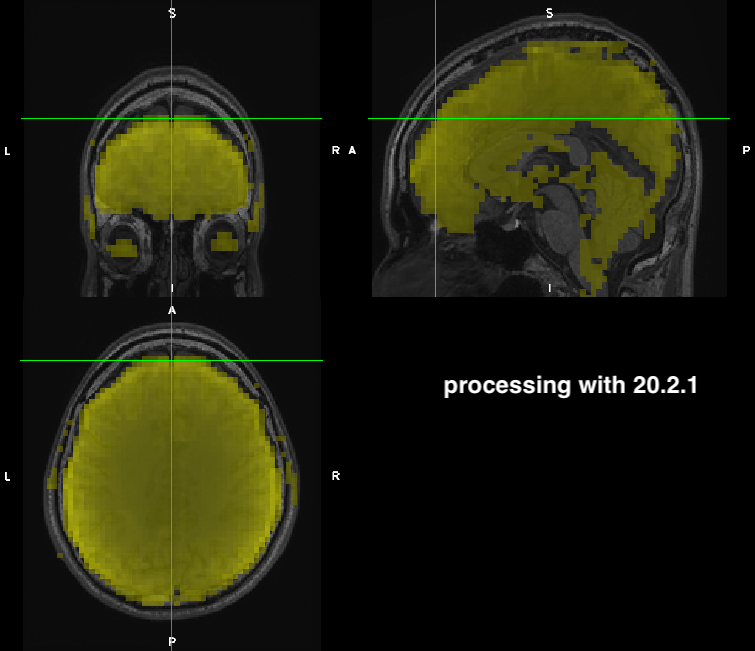 Failed Normalization of BOLD · Issue #2410 · nipreps/fmriprep · GitHub