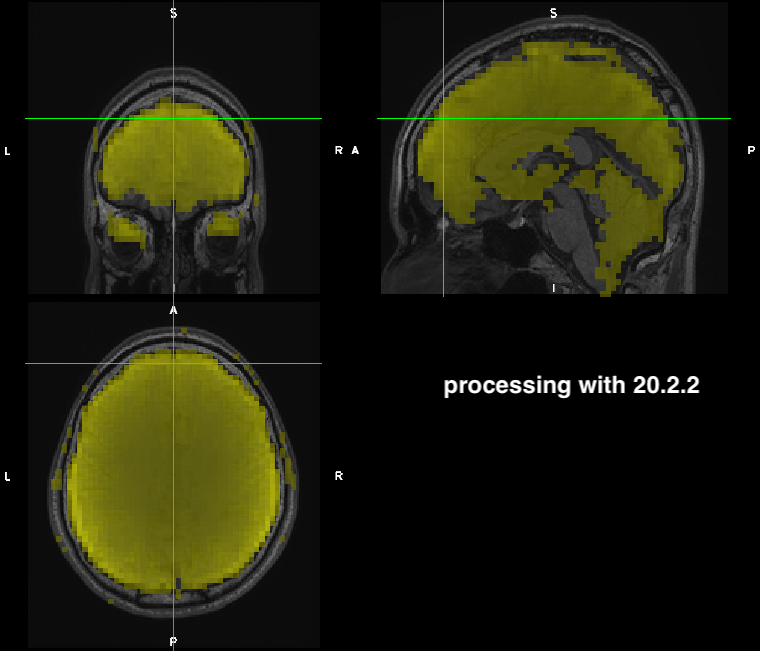 Failed Normalization of BOLD · Issue #2410 · nipreps/fmriprep · GitHub
