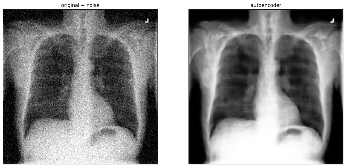 GitHub - ALbaghdadi/Xray_image_enhancment