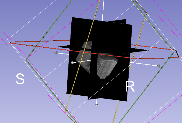 Reslicing oblique 3D ultrasound into a stack of 2D slices · Issue #1 · UCL/fan-slicer · GitHub