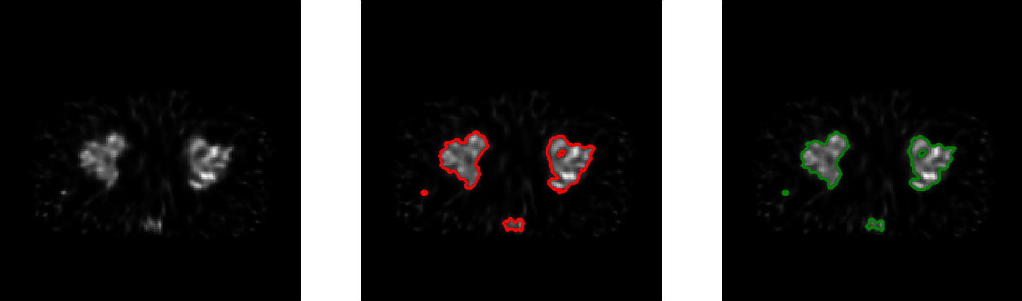 Compare with Chan-Vese model · Issue #1 · junyuchen245/Unsuprevised_Seg_via_CNN · GitHub