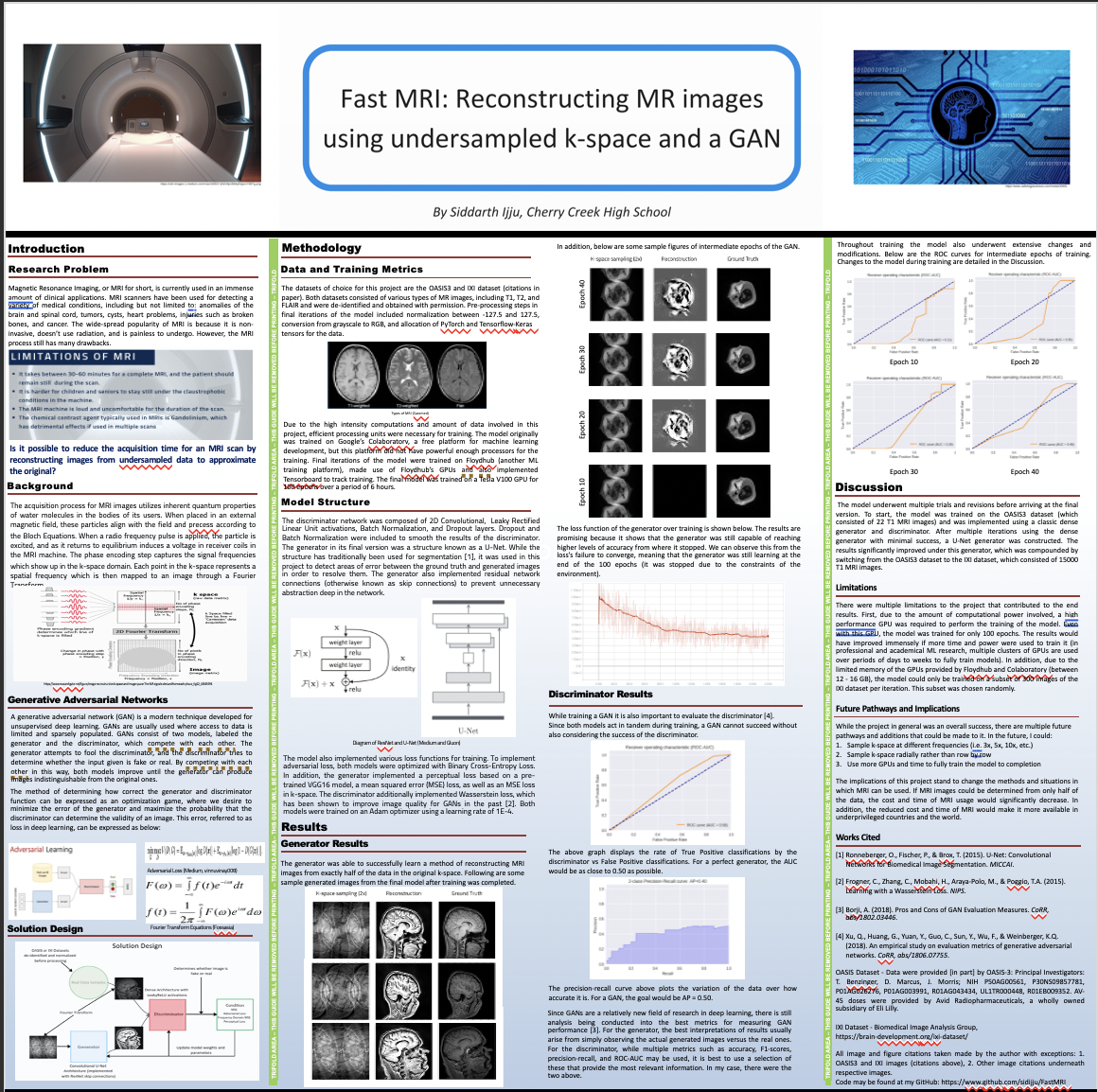 GitHub - sidijju/FastMRI: Science Research 2018-2019. Speed up MRI ...