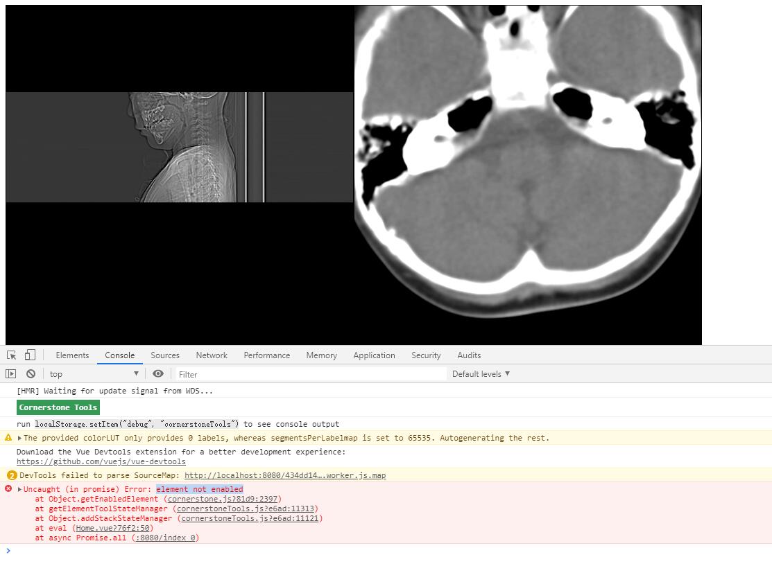 in Vue,Always prompt 'element not enabled' · Issue #1202 · cornerstonejs/cornerstoneTools · GitHub
