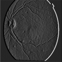 tensorflow - How to get the feature maps from each layers of a trained ...
