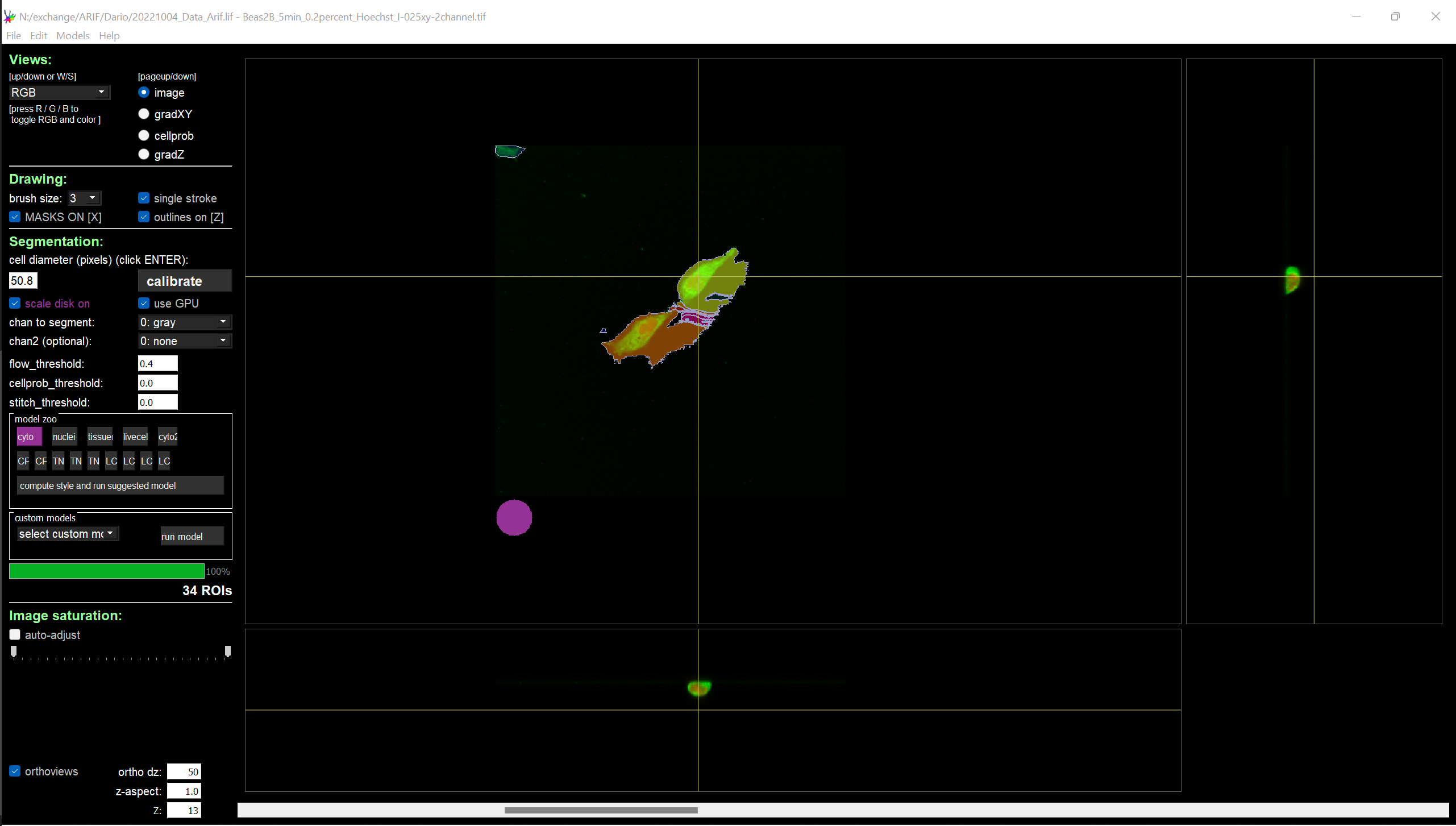 Prediction On Sparse Image Data Cytoplasm Segmentation · Issue 590 · Mouselandcellpose · Github 