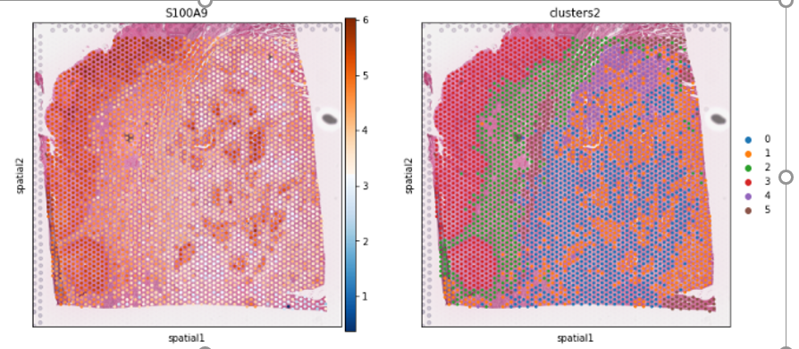 average on 1 gene per cluster (spatial transcriptomic data) · Issue #614 · scverse/squidpy · GitHub