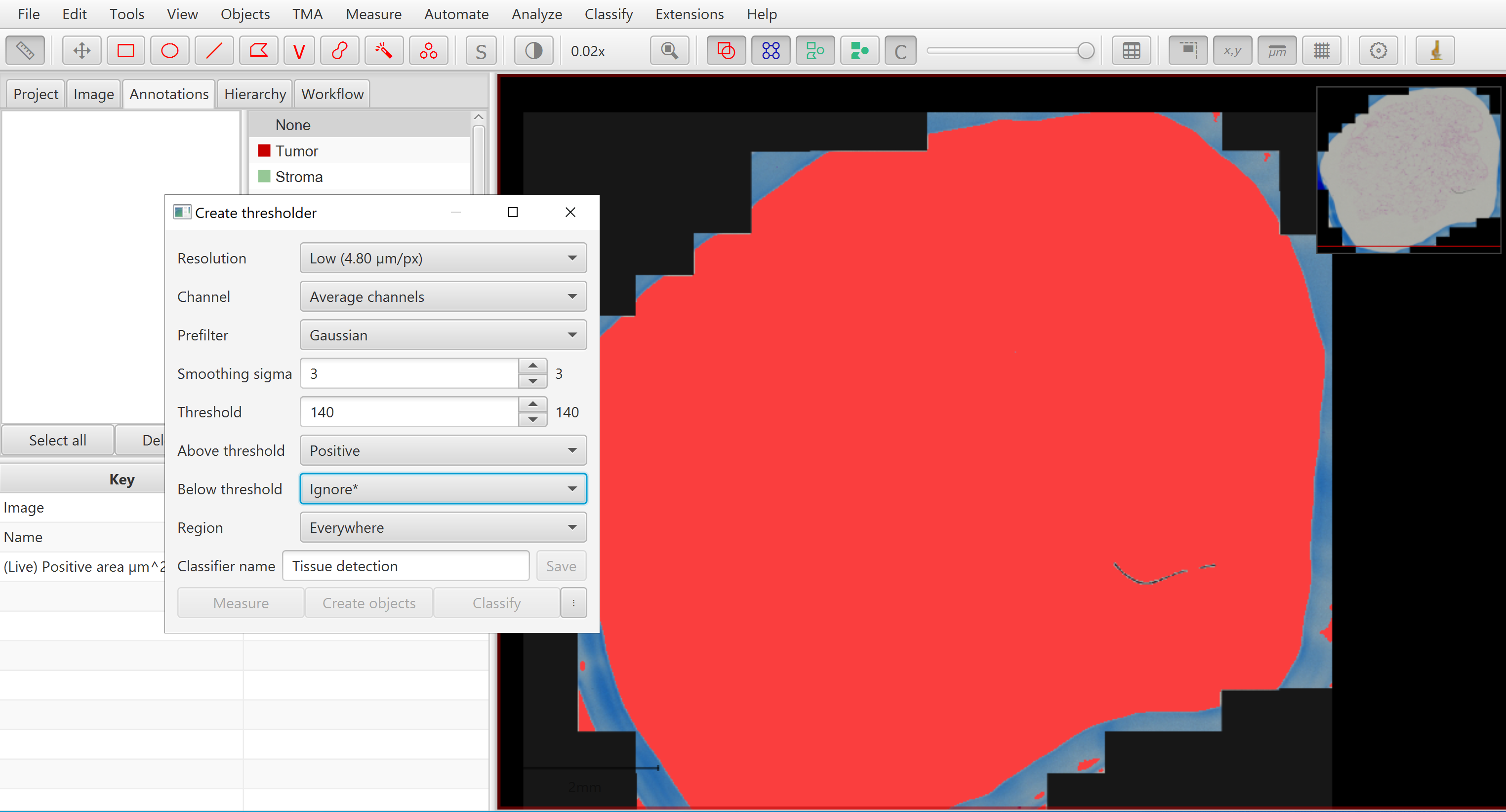 Save Button for the classifier of the Create Thresholder stay disabled · Issue #599 · qupath ...