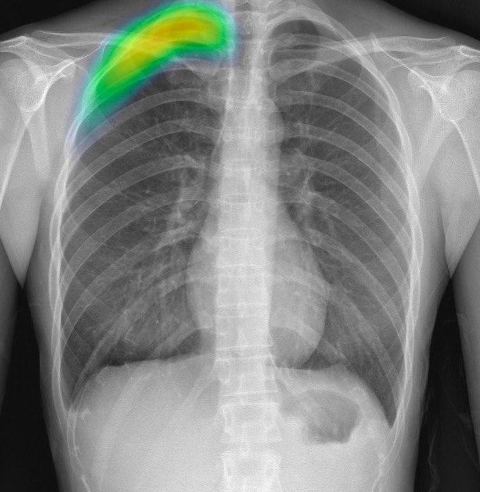 Color Overlay Data · Issue 1054 · Pydicom Pydicom · Github