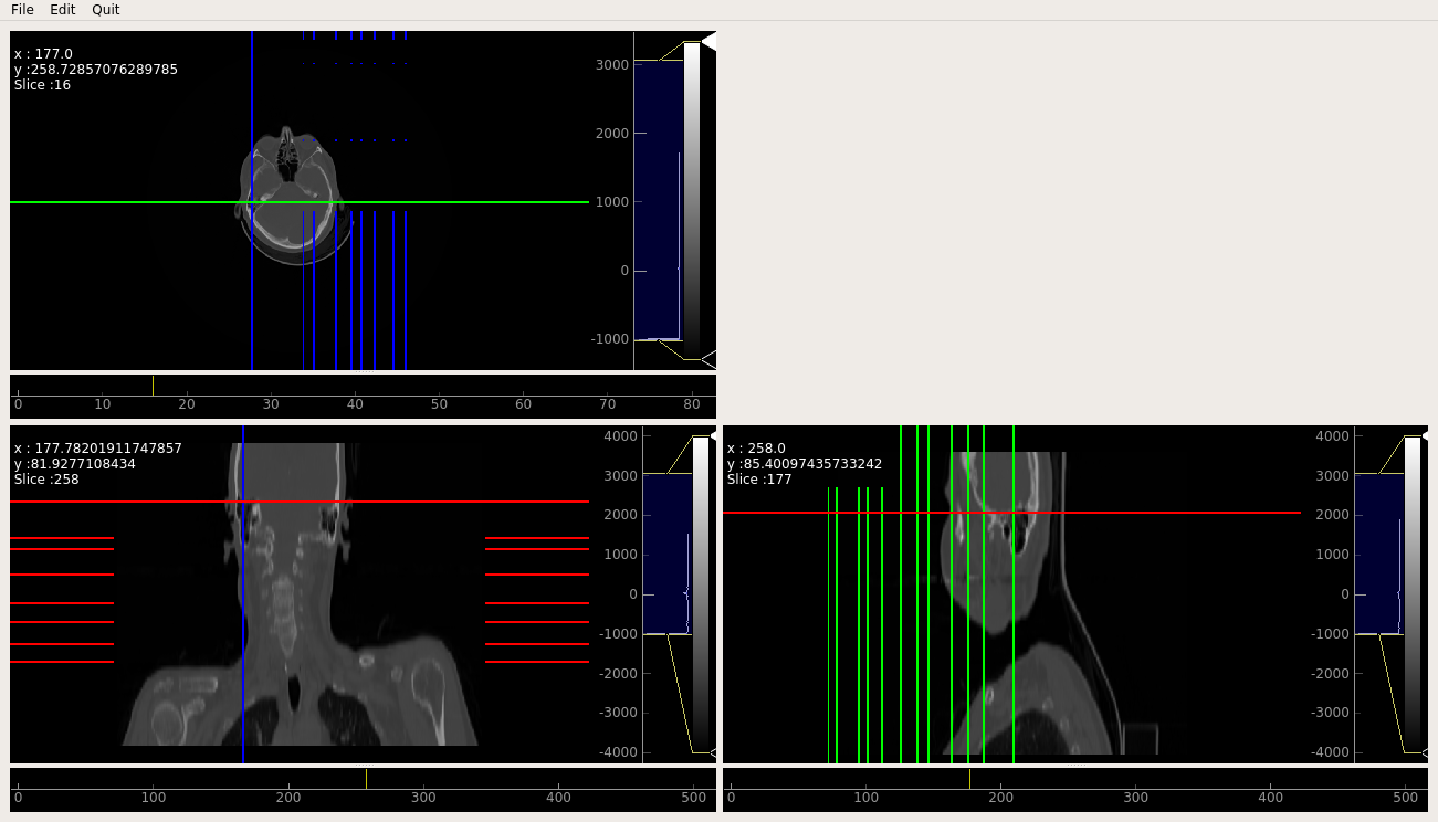 ImageView not refreshing properly (InfiniteLine+QLabel) · Issue #500 · pyqtgraph/pyqtgraph · GitHub