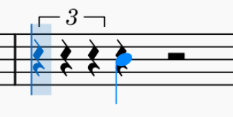 [MU4 Issue] Ordinary eighth note triplets are created as quarters ...