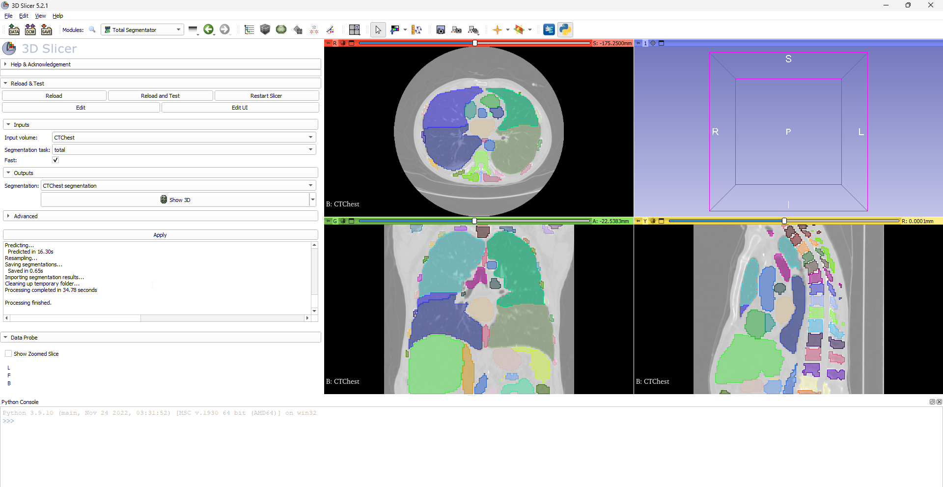 Tests · Issue #1 · lassoan/SlicerTotalSegmentator · GitHub