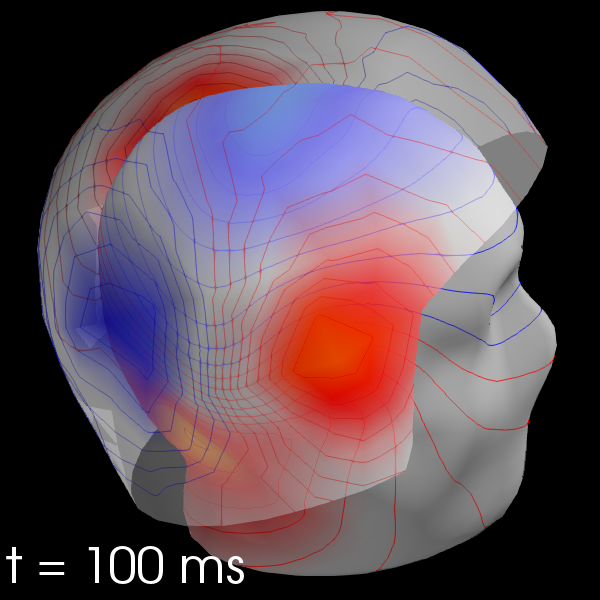 [viz] Rendering Bug In Plot Evoked Field · Issue 5970 · Mne Tools Mne Python · Github