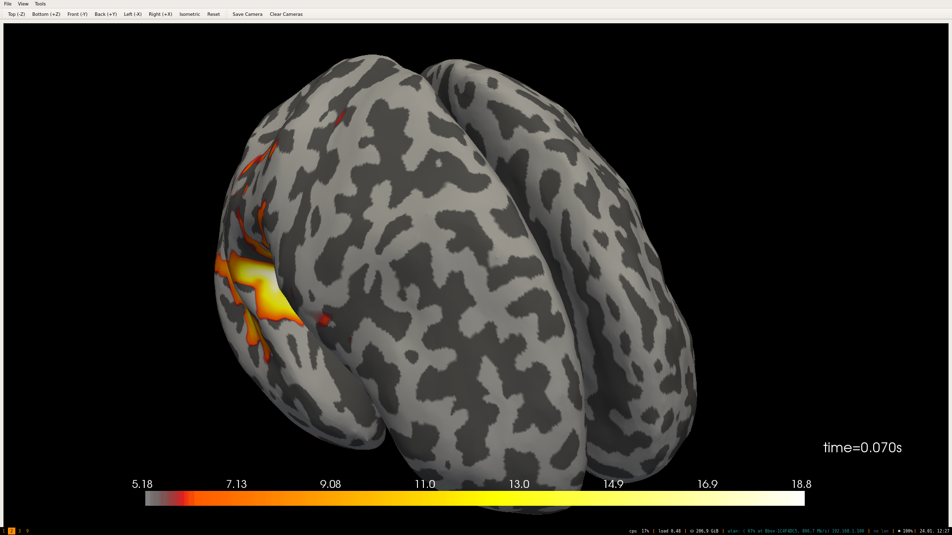 stc.plot with pyvista: error with hemi='both' · Issue #7250 · mne-tools ...
