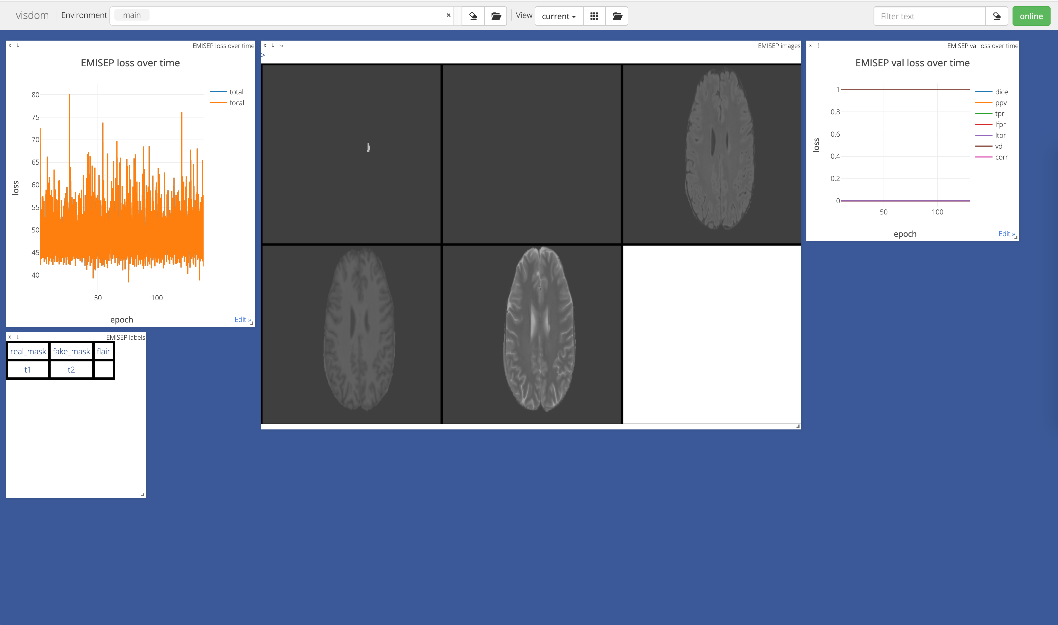 Model not learning anything during training · Issue #9 · MedICL-VU/LesionSeg · GitHub