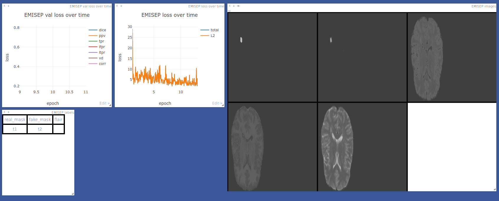 Model not learning anything during training · Issue #9 · MedICL-VU/LesionSeg · GitHub