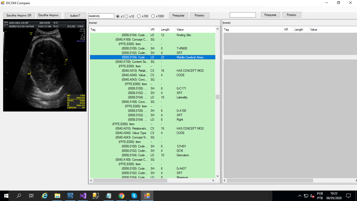 how find measure in structured report · Issue #1027 · fo-dicom/fo-dicom ...