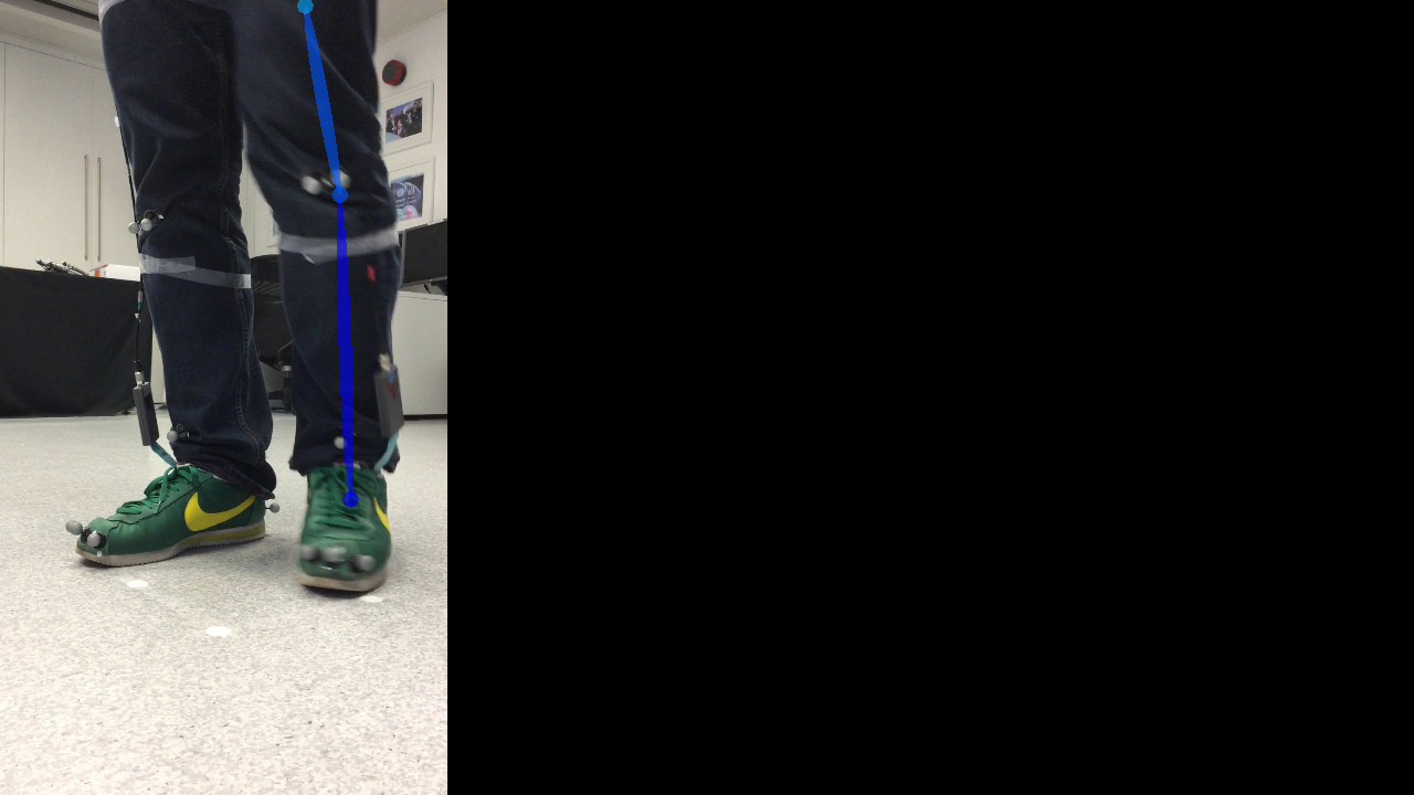 Fail To Detect Keypoints When Only Lower Limbs Are Visible · Issue 360 · Cmu Perceptual 