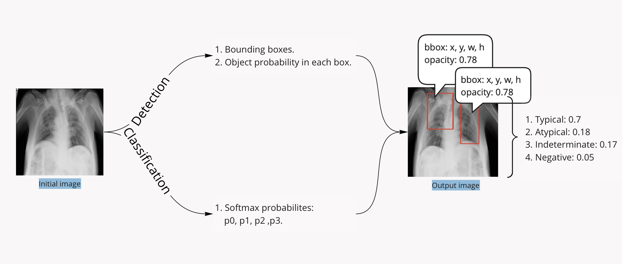 GitHub - DJAlexJ/Covid-Detection-Radiographs: Radiograph detection & classification of COVID ...