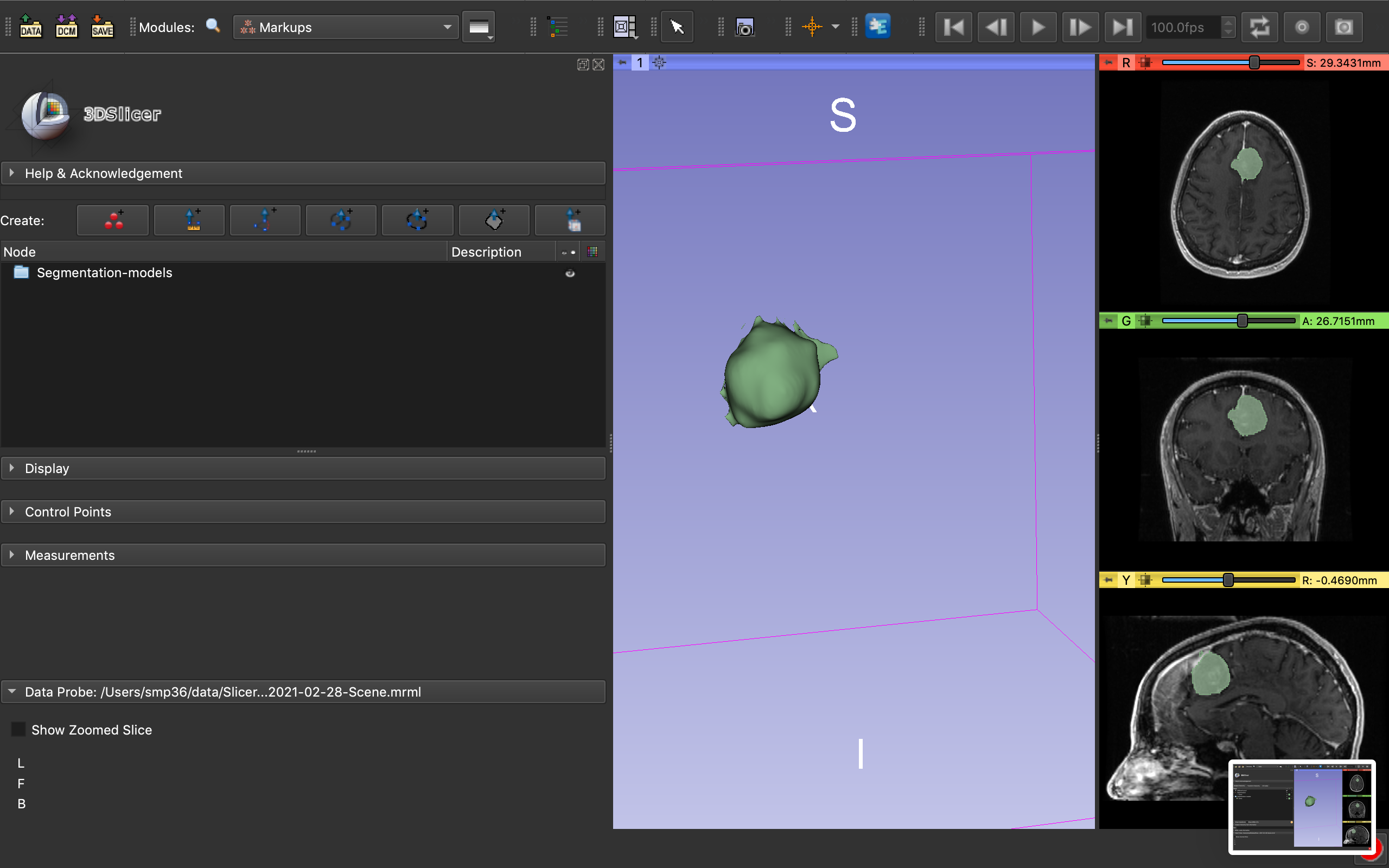 Markups Module shows all subject hierarchy folders · Issue #5493 ...