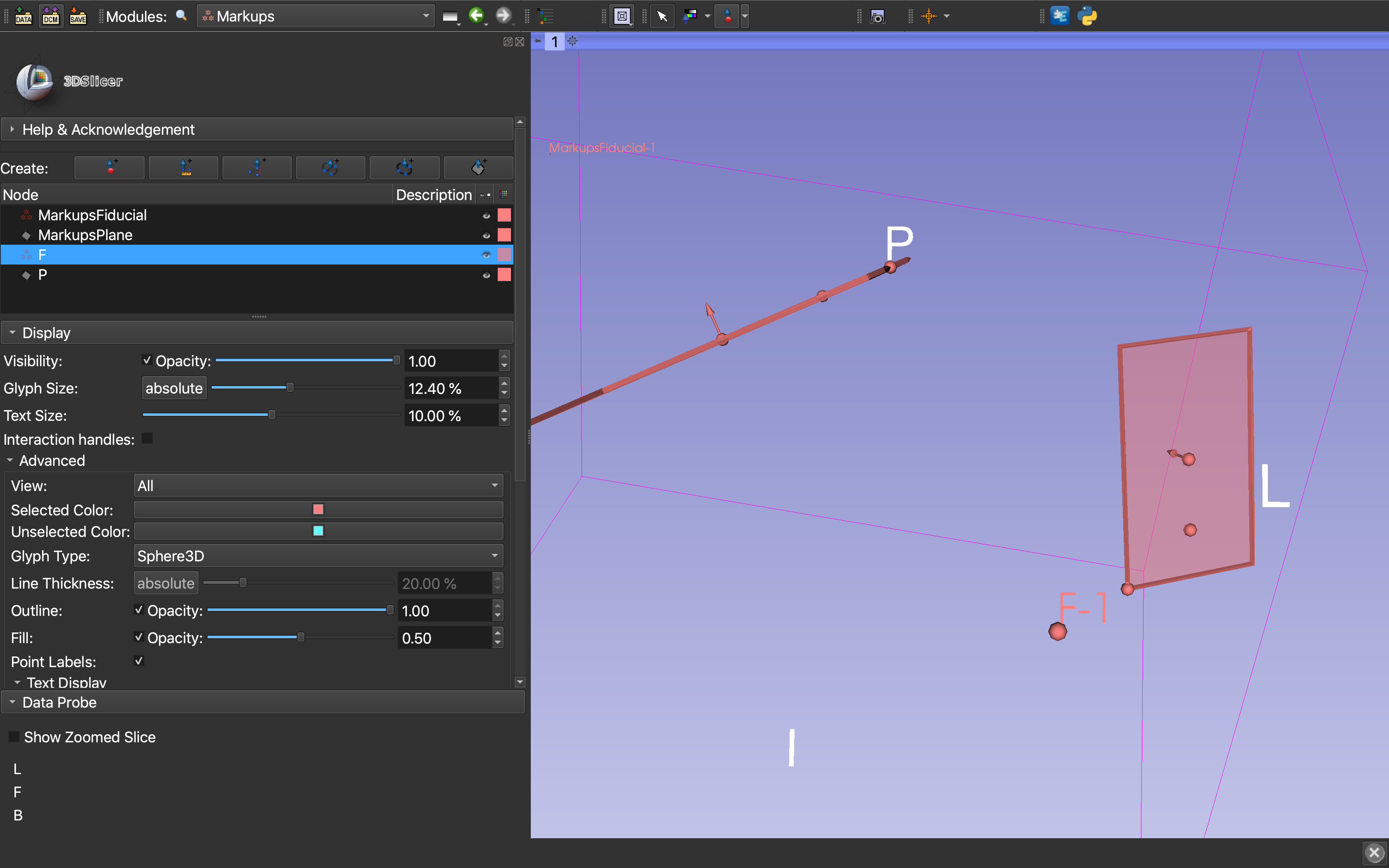 Markups names' consistency · Issue #5196 · Slicer/Slicer · GitHub