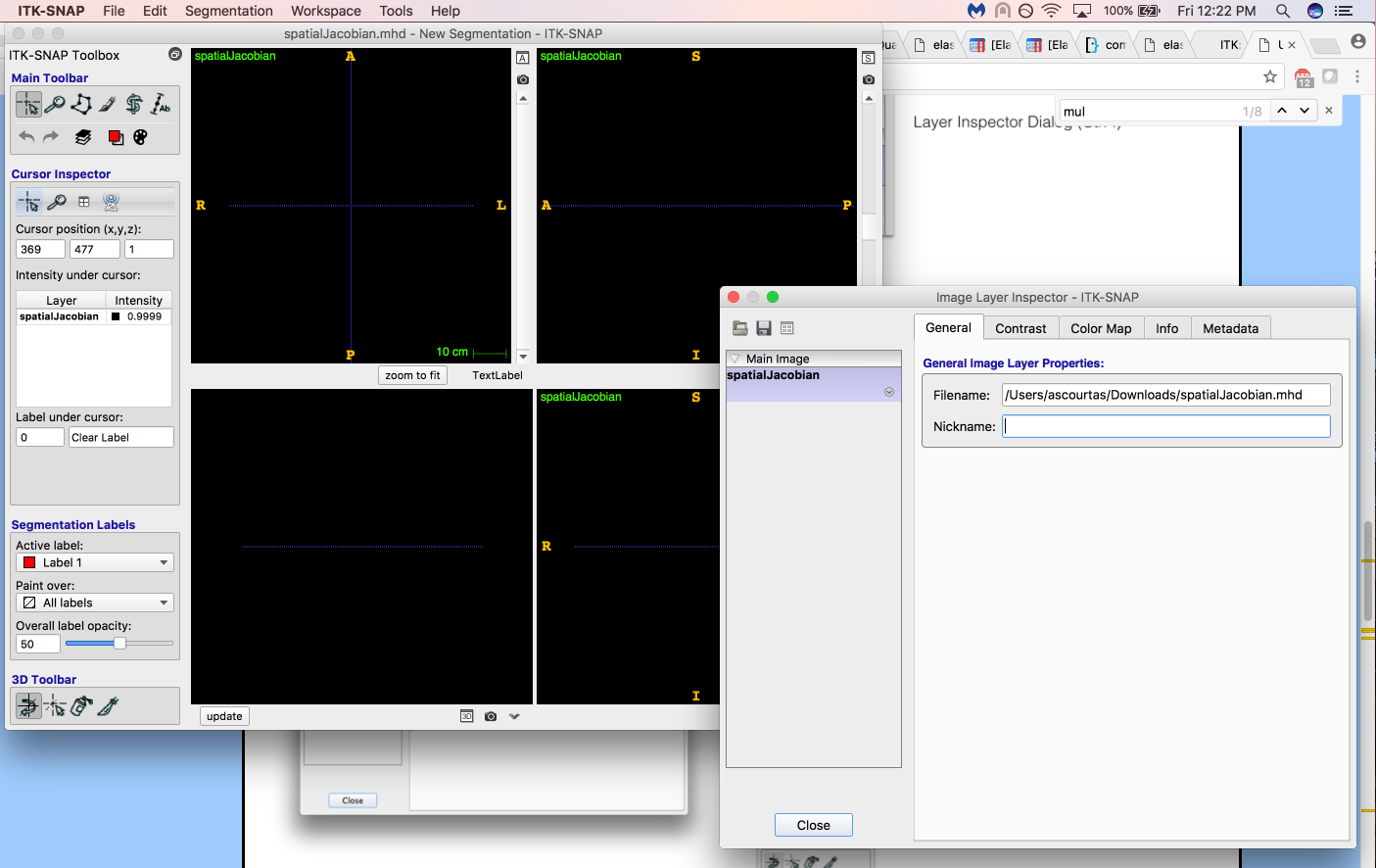 Cant Visualize Deformation Field Or Spatial Jacobian Results · Issue 148 · Superelastix