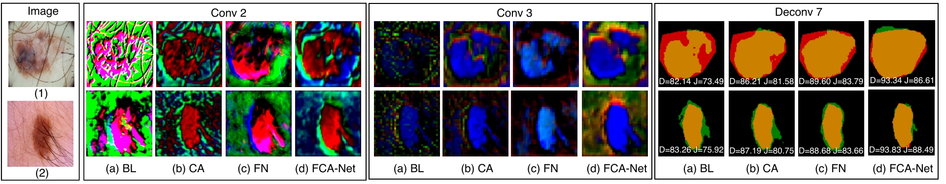 GitHub - vivek231/Skin-Project