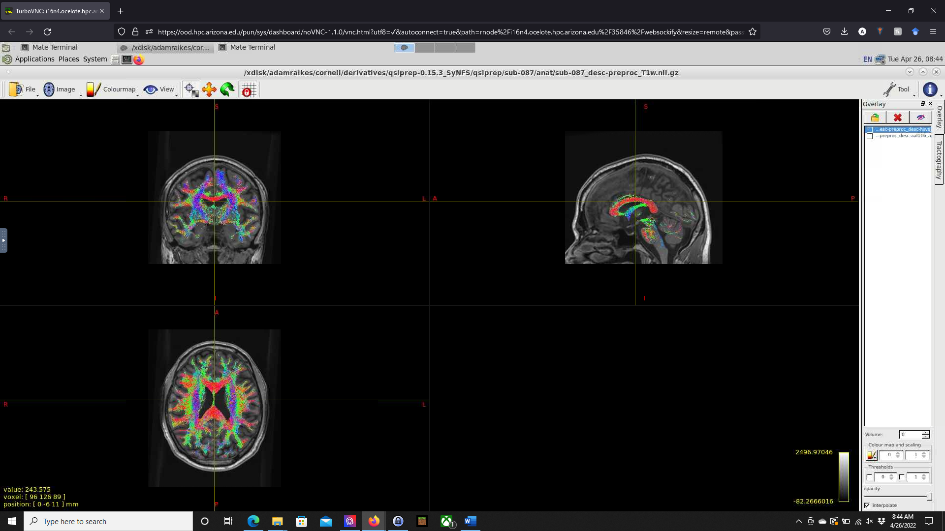 MRtrix SS3T recon question · Issue #404 · PennLINC/qsiprep · GitHub