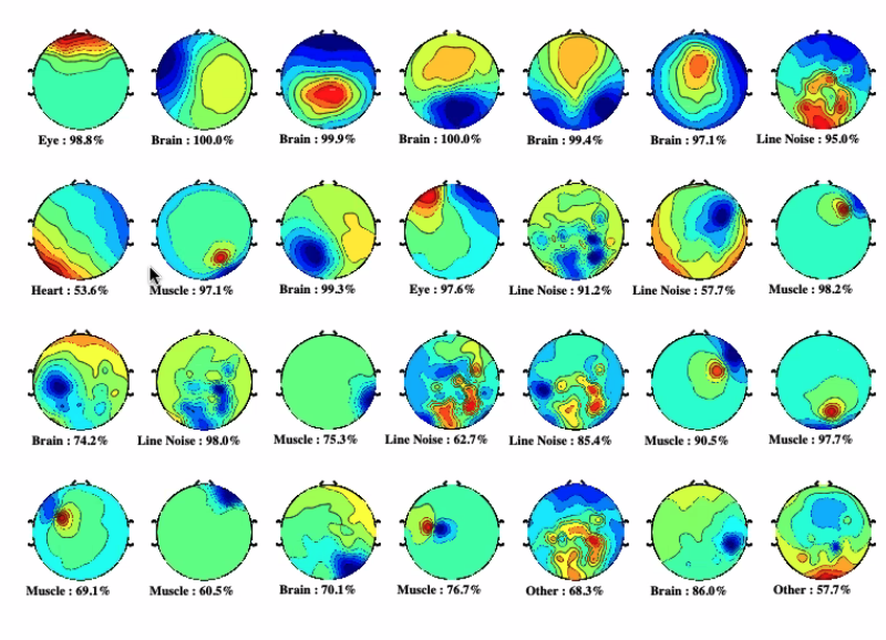 Ic Label Scalp Topo Truncated · Issue 547 · Sccn Eeglab · Github
