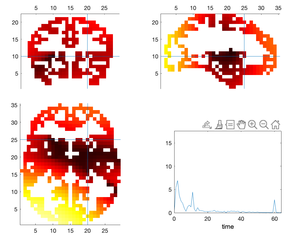 ft_sourceplot cannot plot sourcemodel defined using vertices depicting a volume with holes ...