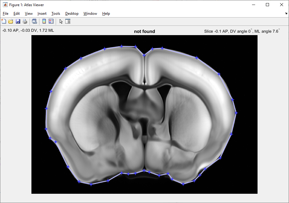 GitHub - wanglab-neuro/Allen_CCF_reg