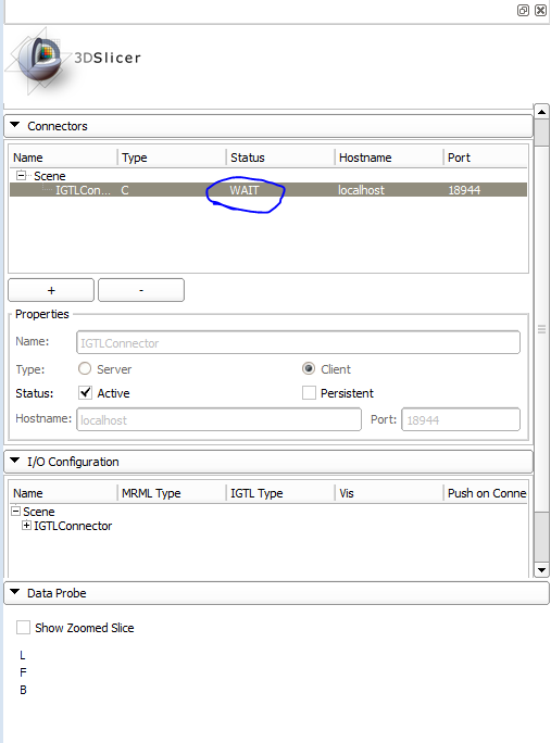 Troubleshooting connection to hardware using Plus and SlicerIGT · Issue #359 · PlusToolkit ...