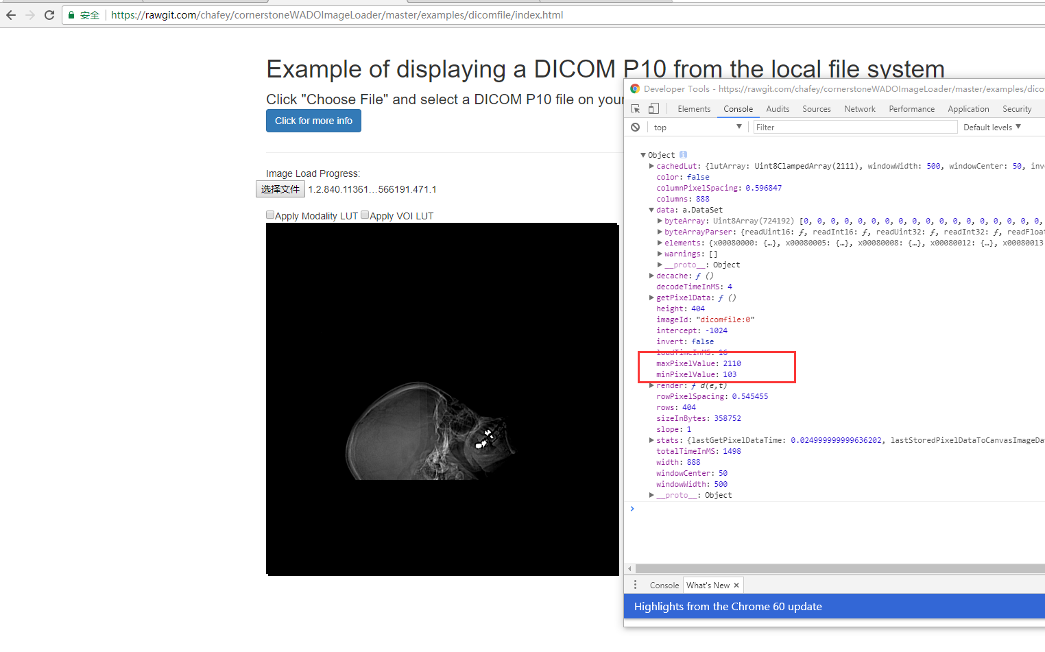 Display DICOM images with cornerstoneWADOImageLoader, but lose grayscale · Issue #124 ...