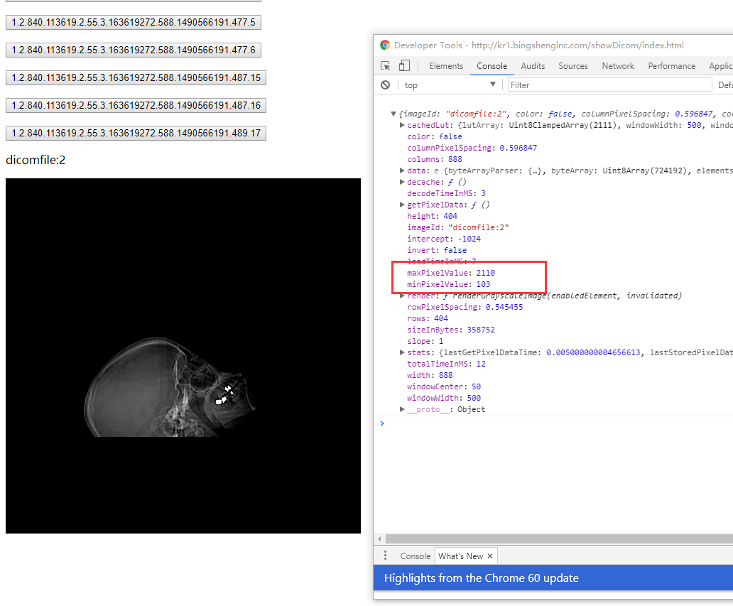 Display DICOM images with cornerstoneWADOImageLoader, but lose grayscale · Issue #124 ...