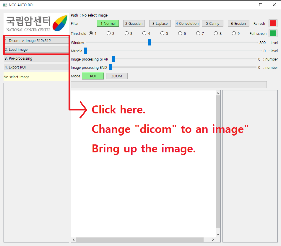 Github Sungminyoon Ncc Alpha Auto Roi Alpha
