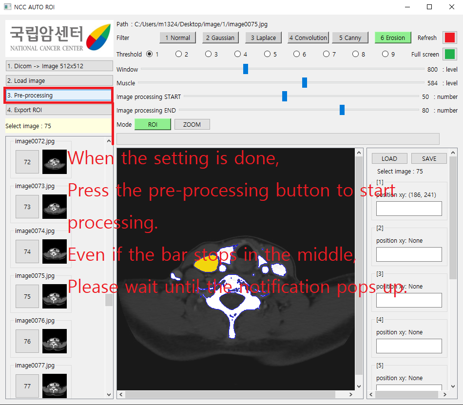 GitHub - sungminYoon/NCC_ALPHA: AUTO_ROI_ALPHA
