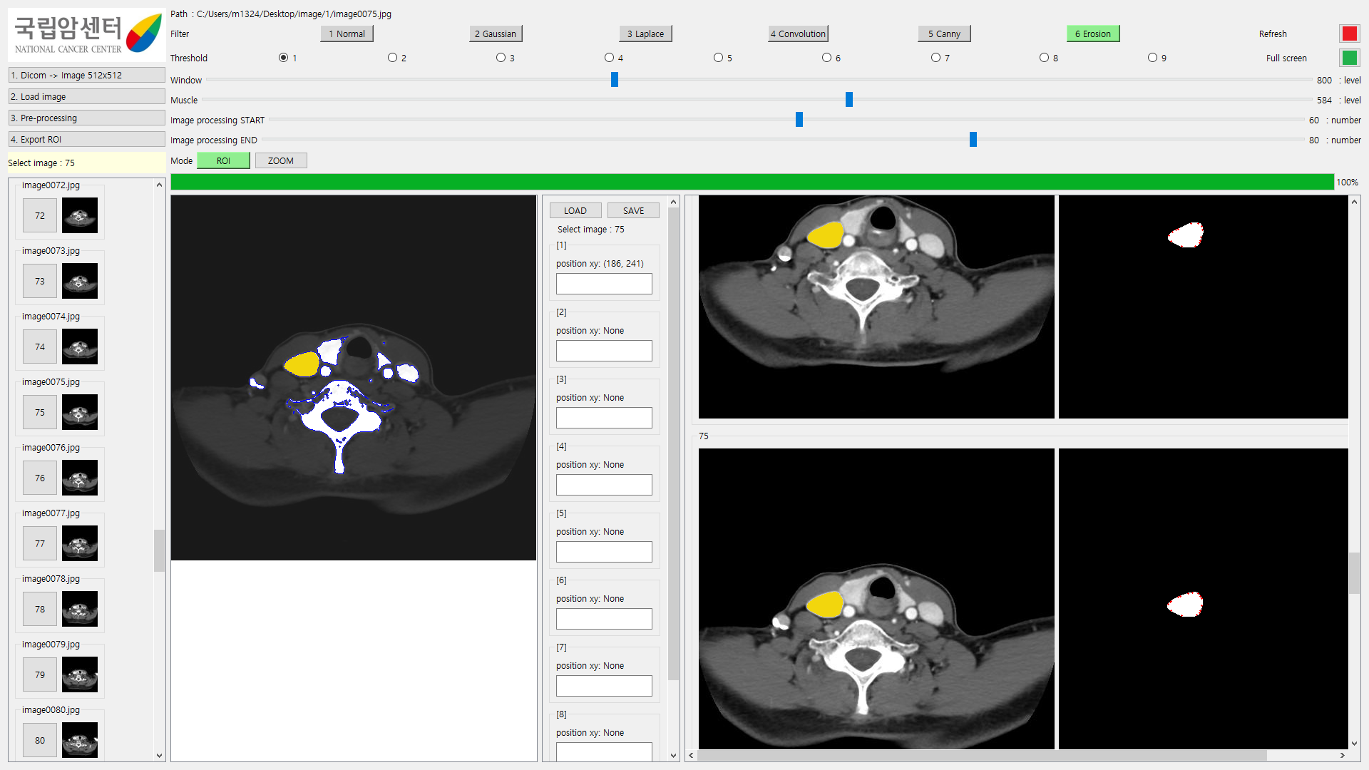 GitHub - sungminYoon/NCC_ALPHA: AUTO_ROI_ALPHA