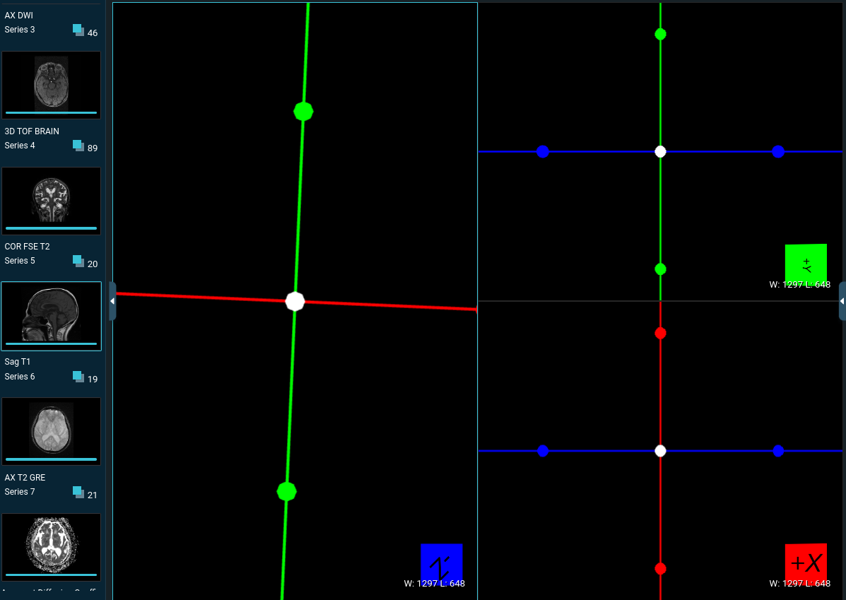 Imagereslice Does Not Work Properly With Mri · Issue 2557 · Kitware 