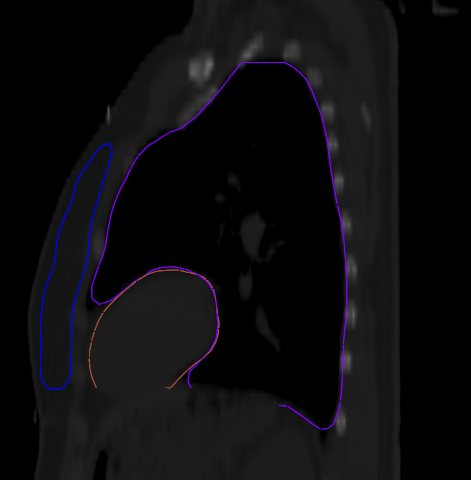 How to display multiple line segments with one actor · Issue #914 ...