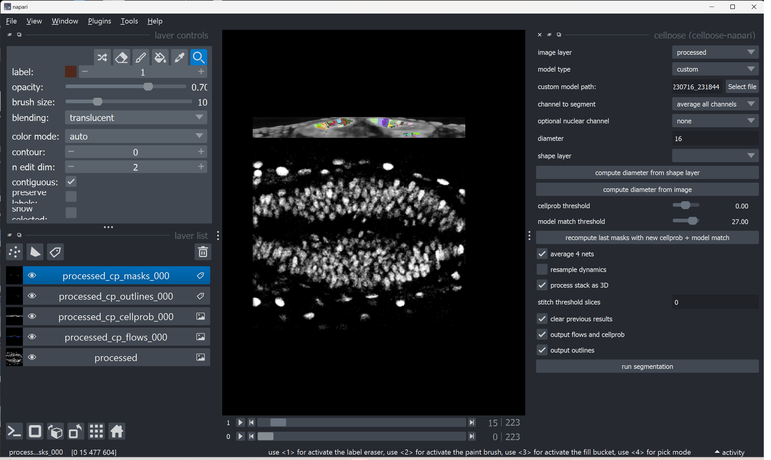 4D stack segmentation appears smashed at the top of the image. · Issue ... 4D stack segmentation appears smashed at the top of the image. · Issue ...