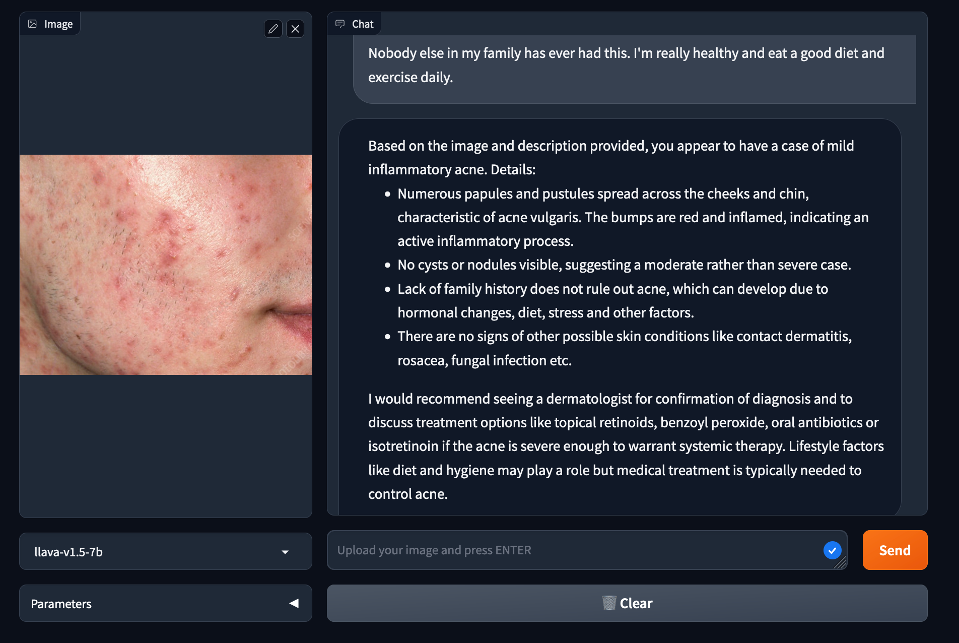 GitHub - gianlucatruda/pore-patrol-multimodal-llm: A demo for the Anthropic Hackathon. LLaVa ...