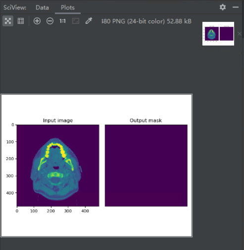 It can be trained but not predictable · Issue #201 · milesial/Pytorch-UNet · GitHub