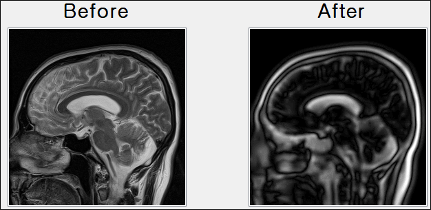GitHub - SoobumKim/Medical_image_processing_GUI