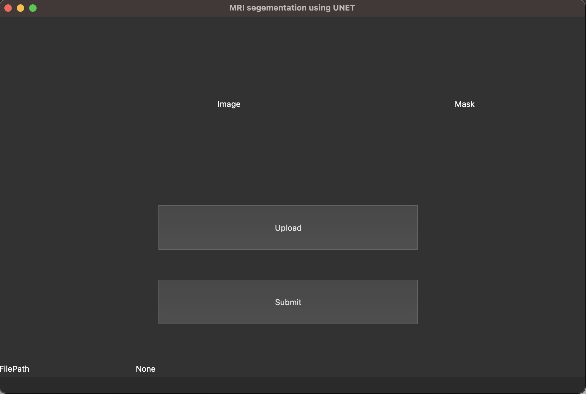 GitHub - esshariprasad/Brain-MRI-Segmentation-Using-Unet