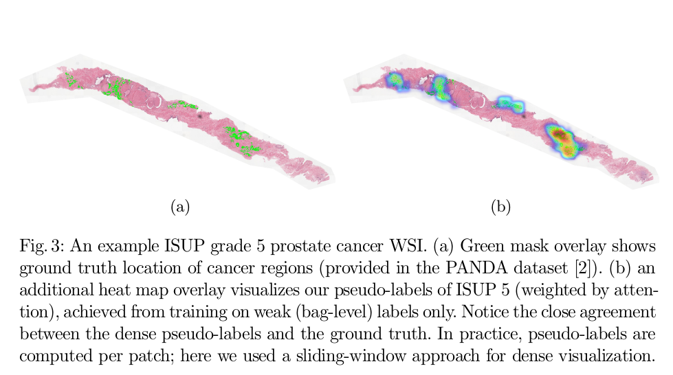 Multiple Instance Learning: SplitDimd TypeError: __init__() got an unexpected keyword argument ...