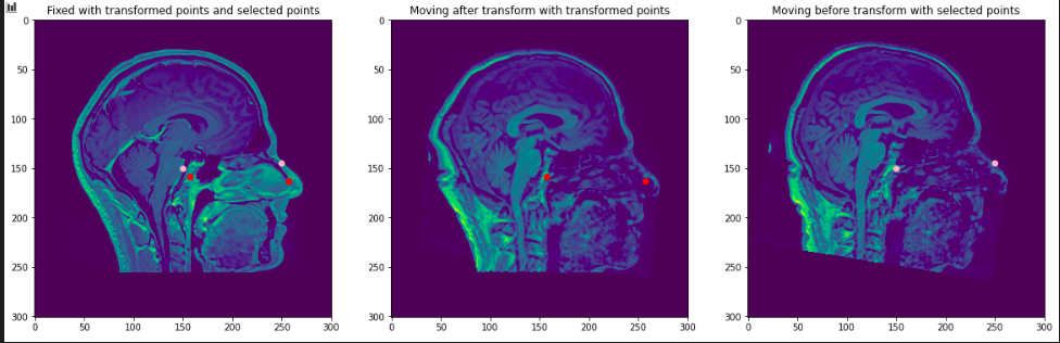Inverse transform of scalp points not working as expected · Issue #257 · ANTsX/ANTsPy · GitHub