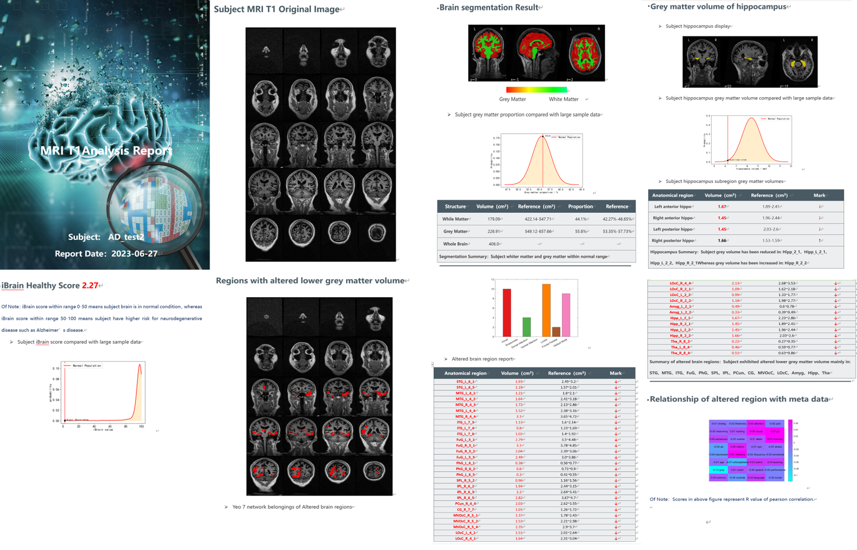 GitHub - YongLiuLab/iBrain