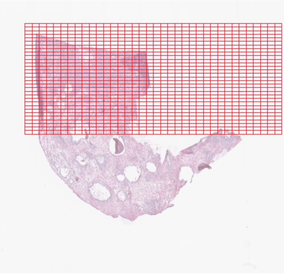 Biggest tissue box coordinates are inverted (PIL -> NumPy) · Issue #184 ...